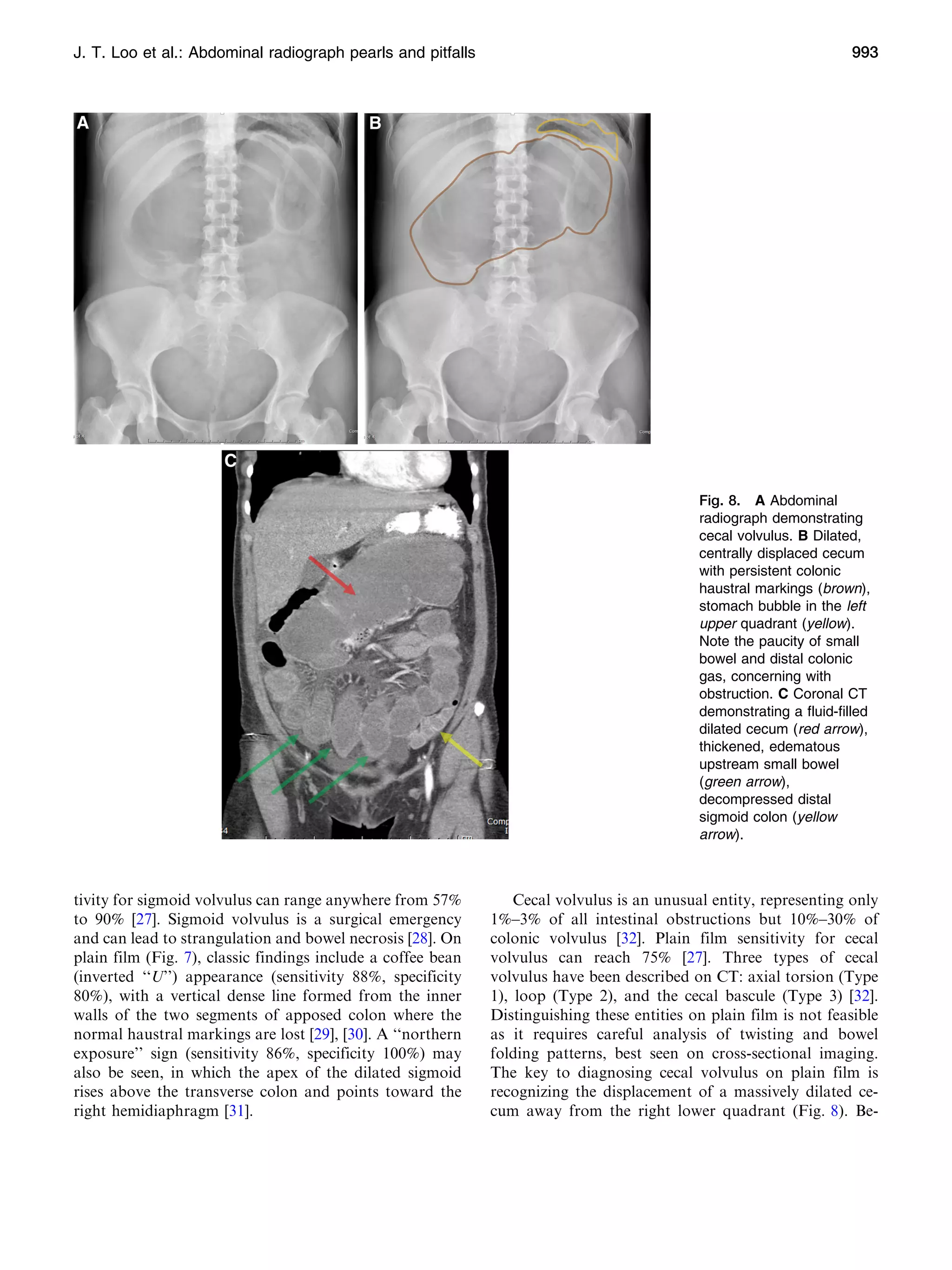 Abdominal radiograph | PDF