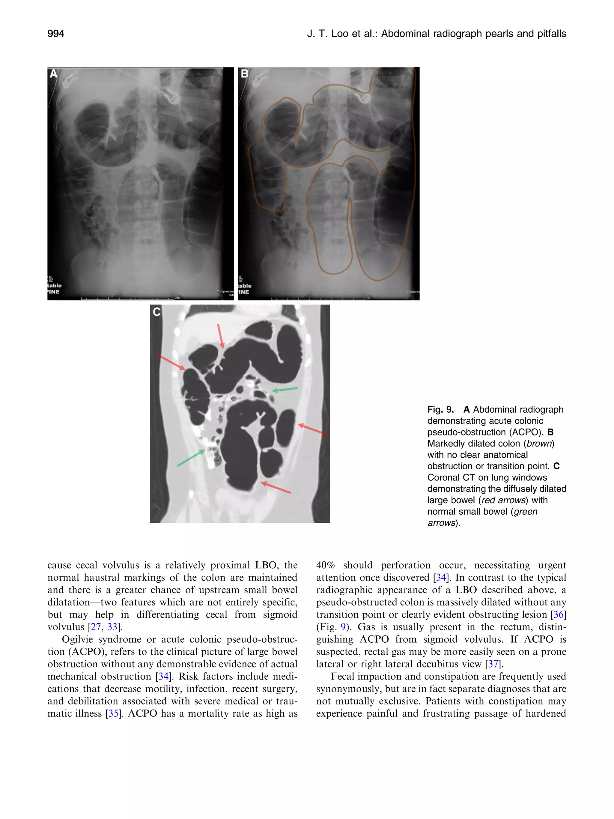 Abdominal radiograph | PDF