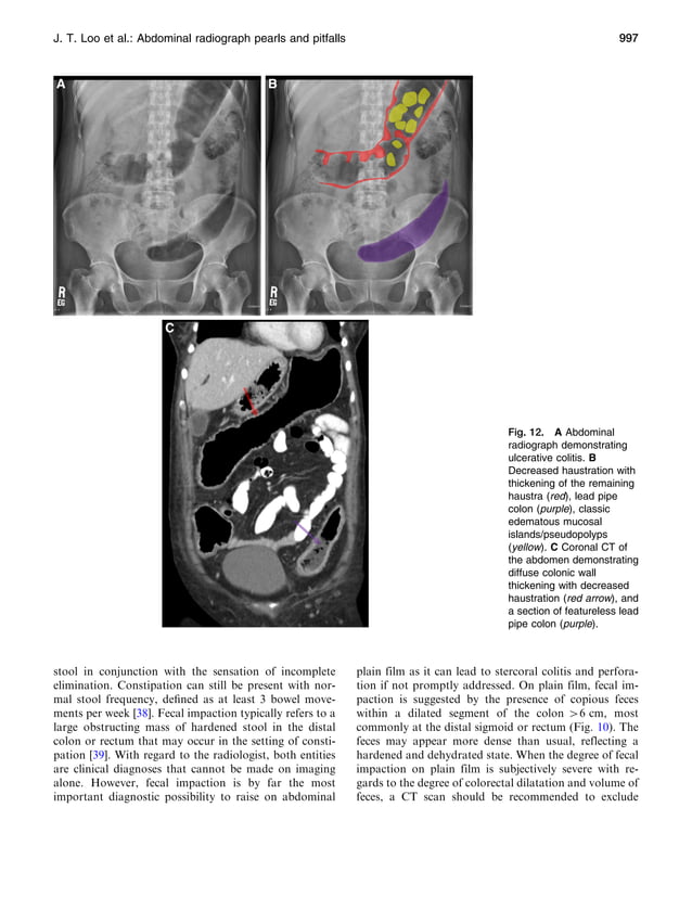 Abdominal radiograph | PDF