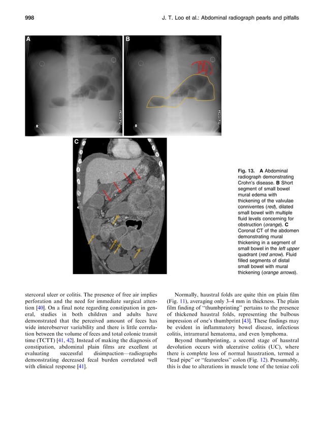 Abdominal radiograph | PDF