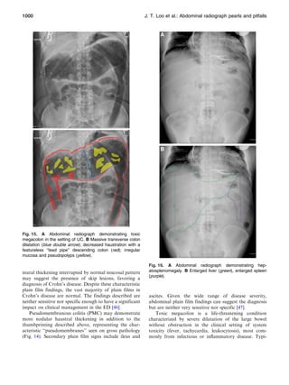 Abdominal radiograph | PDF