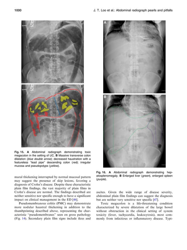 Abdominal radiograph | PDF