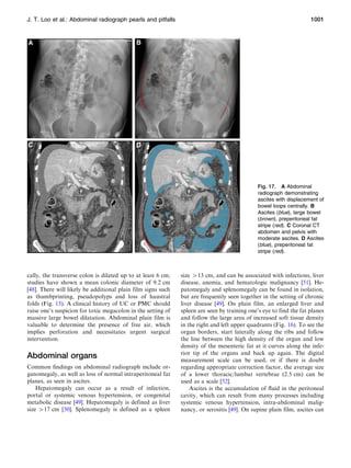 Abdominal radiograph | PDF