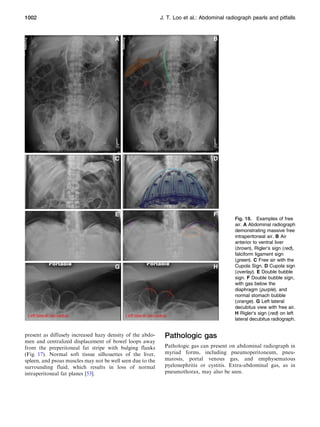 Abdominal radiograph | PDF