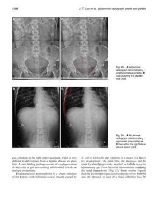 Abdominal radiograph | PDF