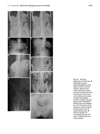 Abdominal radiograph | PDF