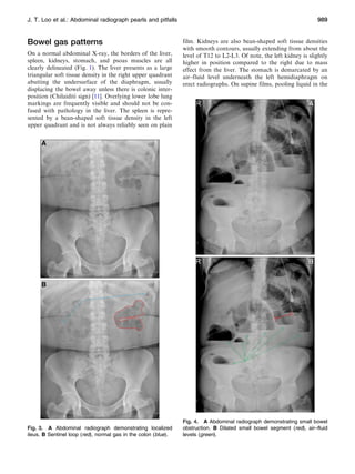 Abdominal radiograph | PDF