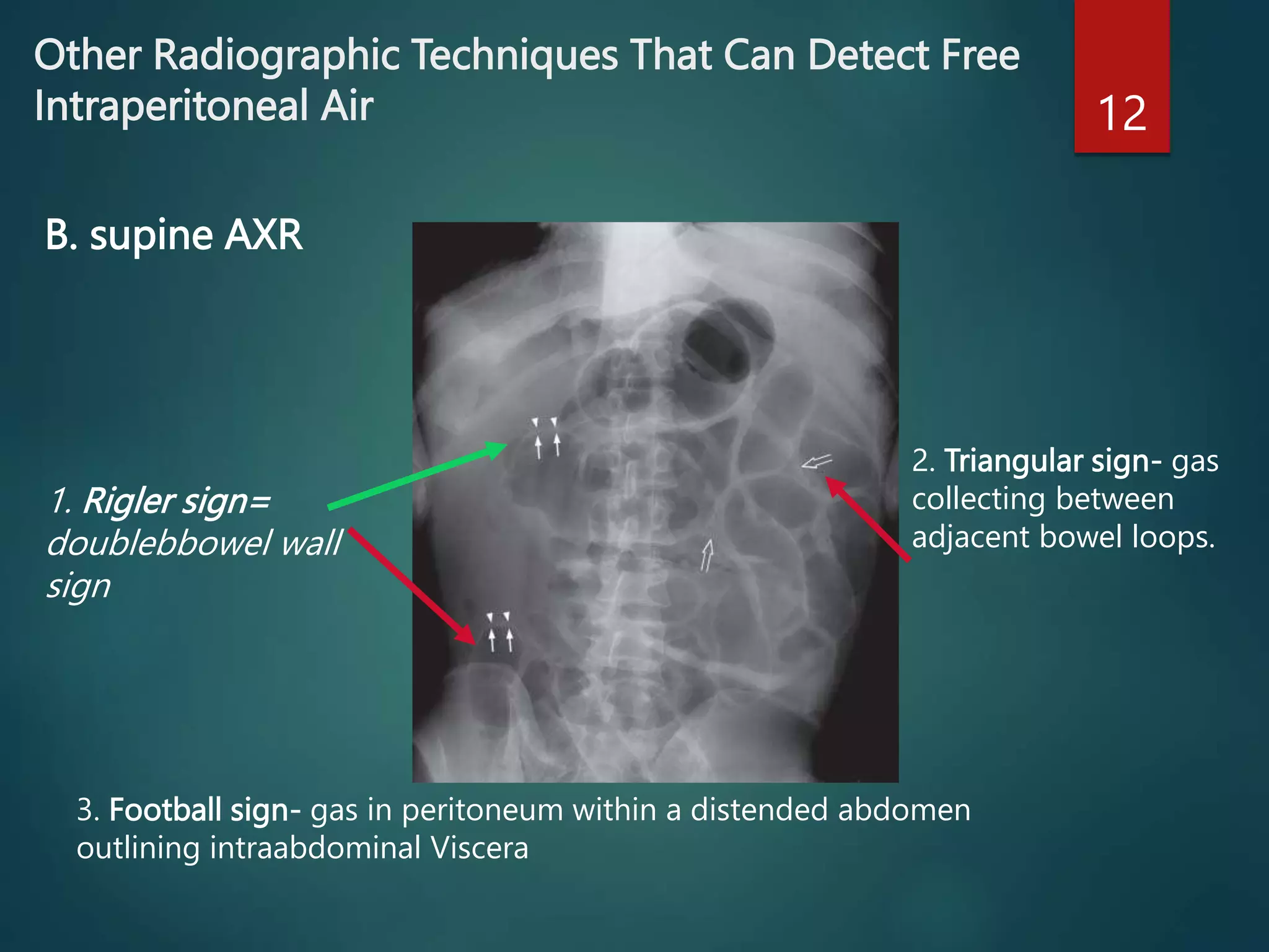 ABDOMINAL RADIOGRAPHY.pptx.pptx