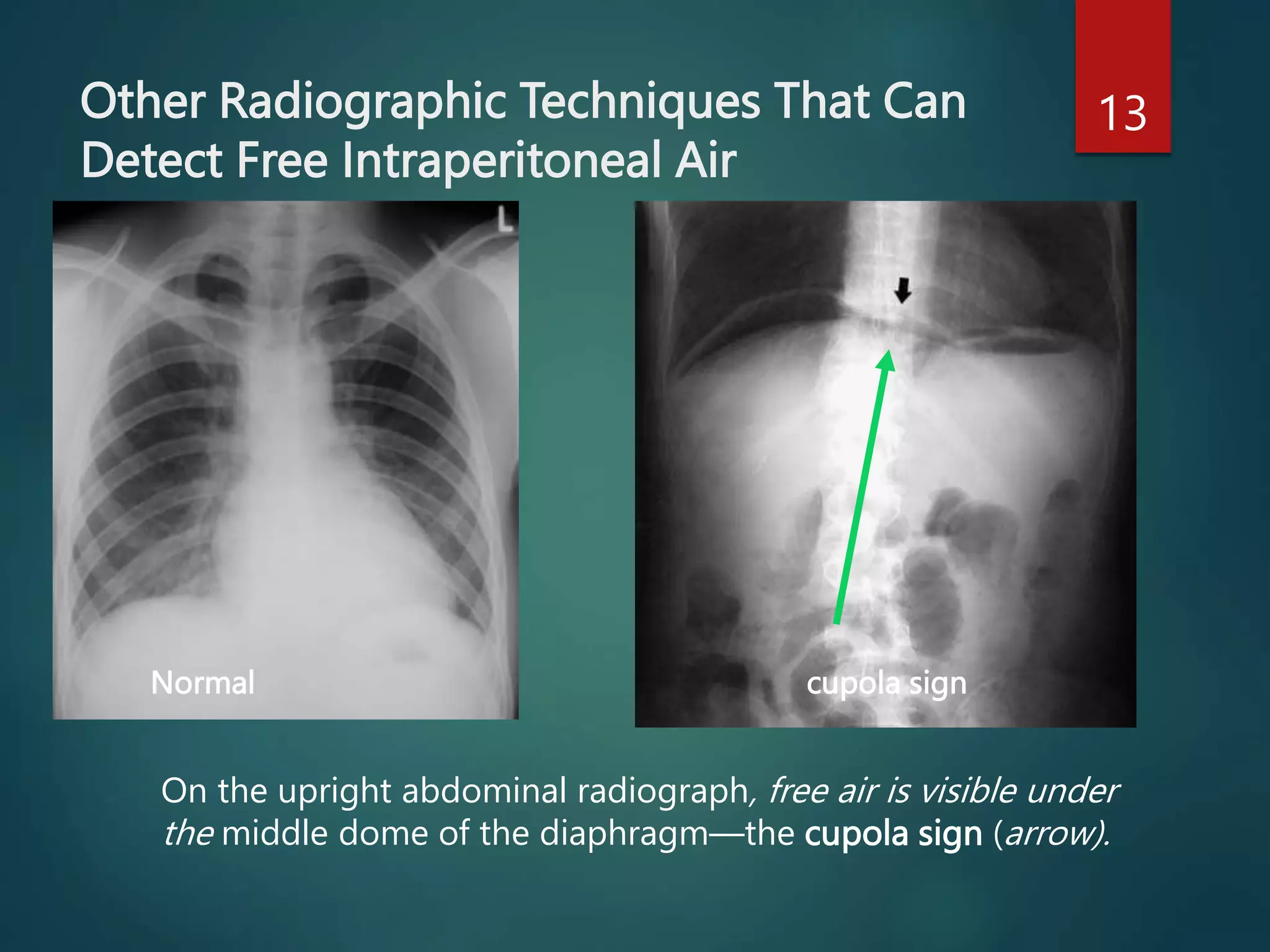 ABDOMINAL RADIOGRAPHY.pptx.pptx
