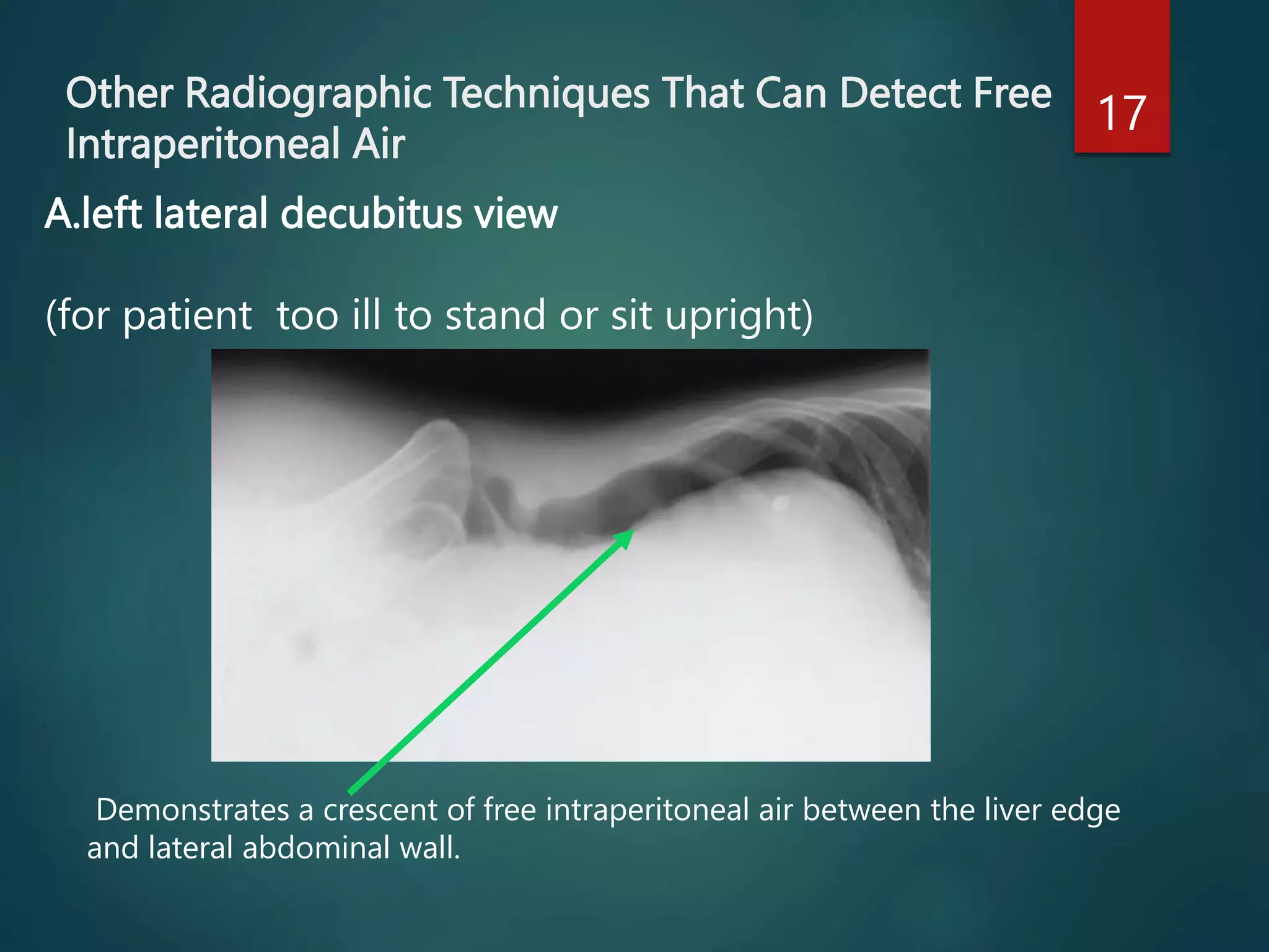 ABDOMINAL RADIOGRAPHY.pptx.pptx