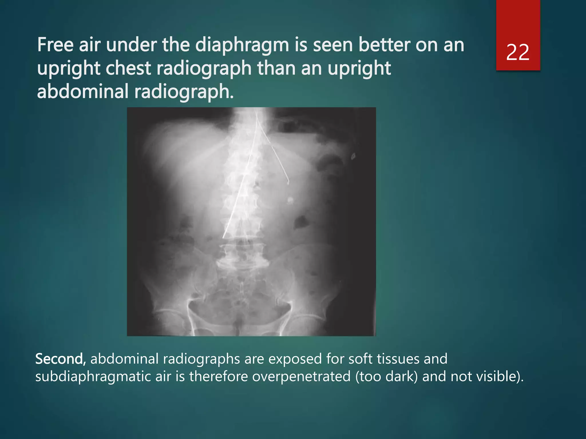 ABDOMINAL RADIOGRAPHY.pptx.pptx
