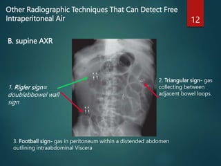 ABDOMINAL RADIOGRAPHY.pptx.pptx