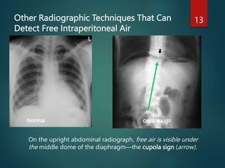 ABDOMINAL RADIOGRAPHY.pptx.pptx