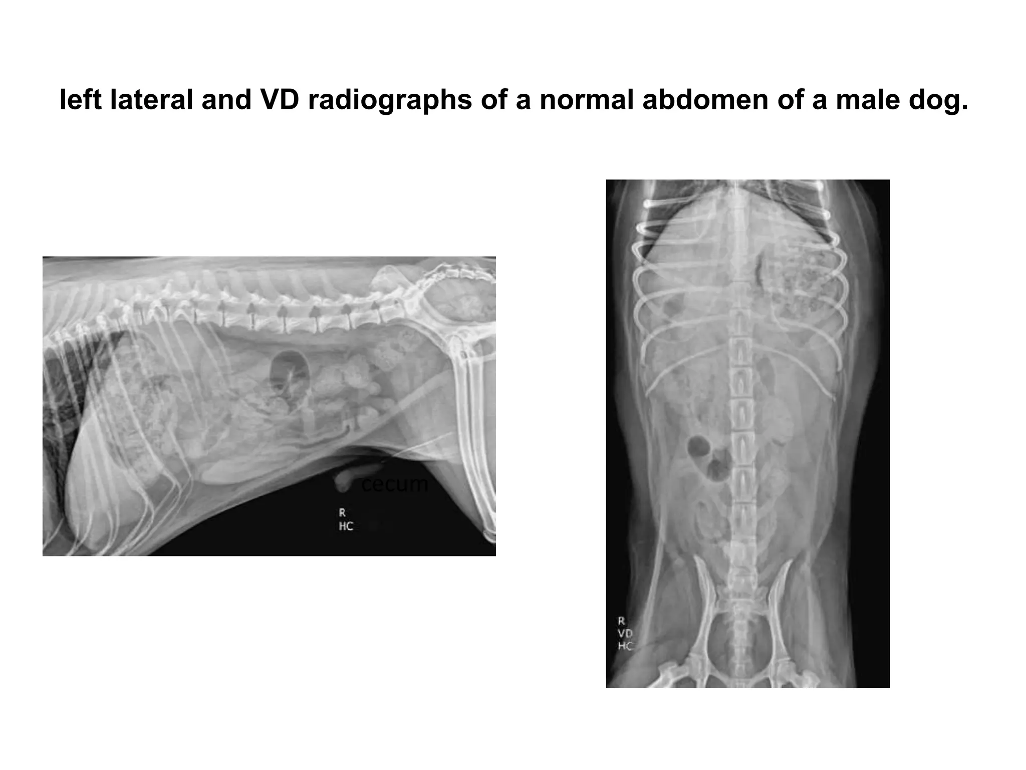 abdominal radiography with its pectoral demonstration.pptx