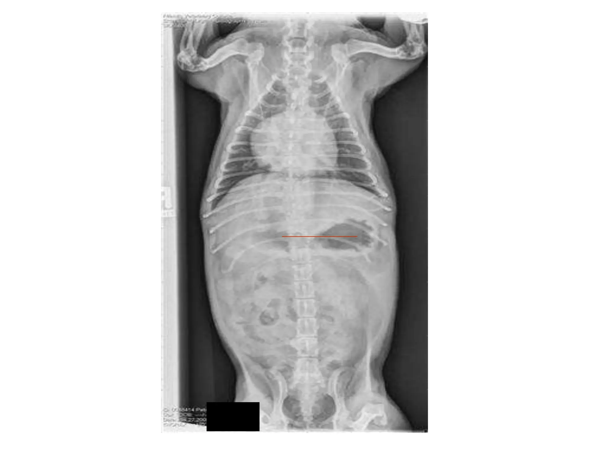 abdominal radiography with its pectoral demonstration.pptx | Digestive ...