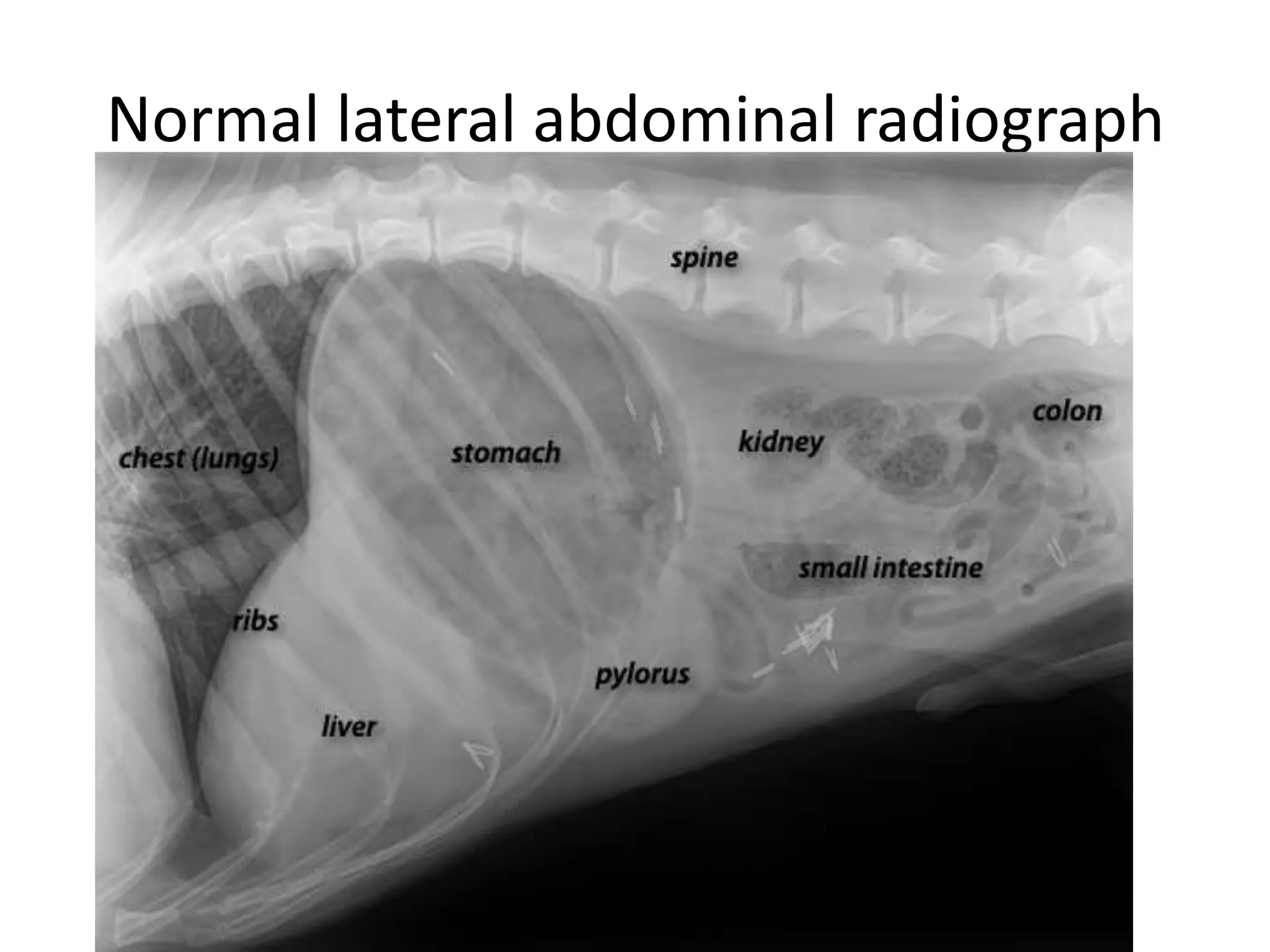 abdominal radiography with its pectoral demonstration.pptx