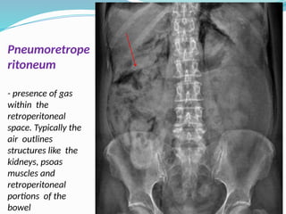 Abdominal Radiology - x-rays of abdomen | PPTX