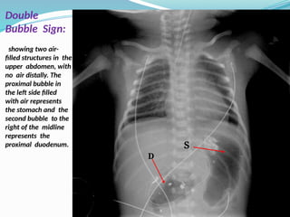 Abdominal Radiology - x-rays of abdomen | PPTX