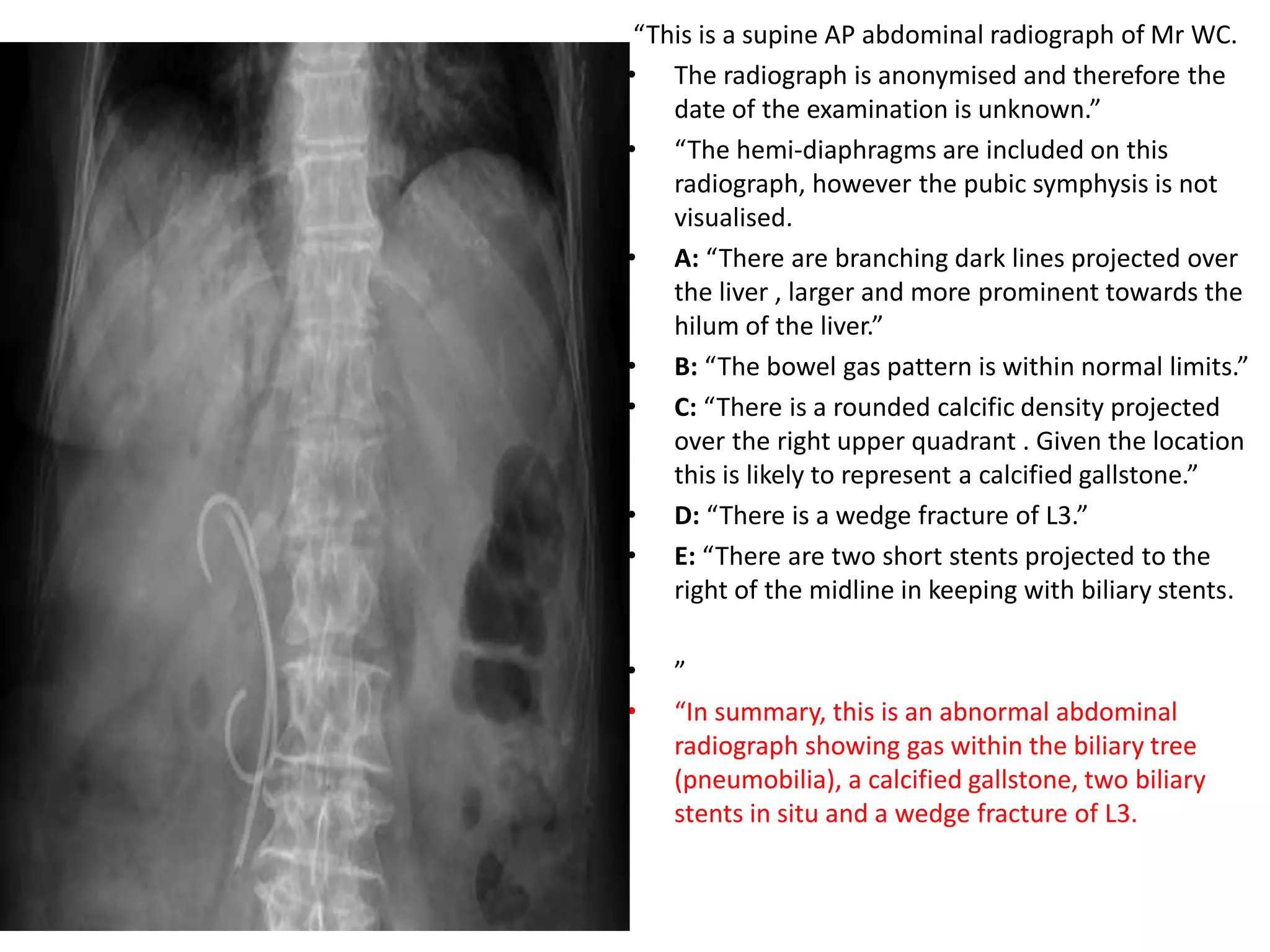ABDOMINAL REPORT.pptx