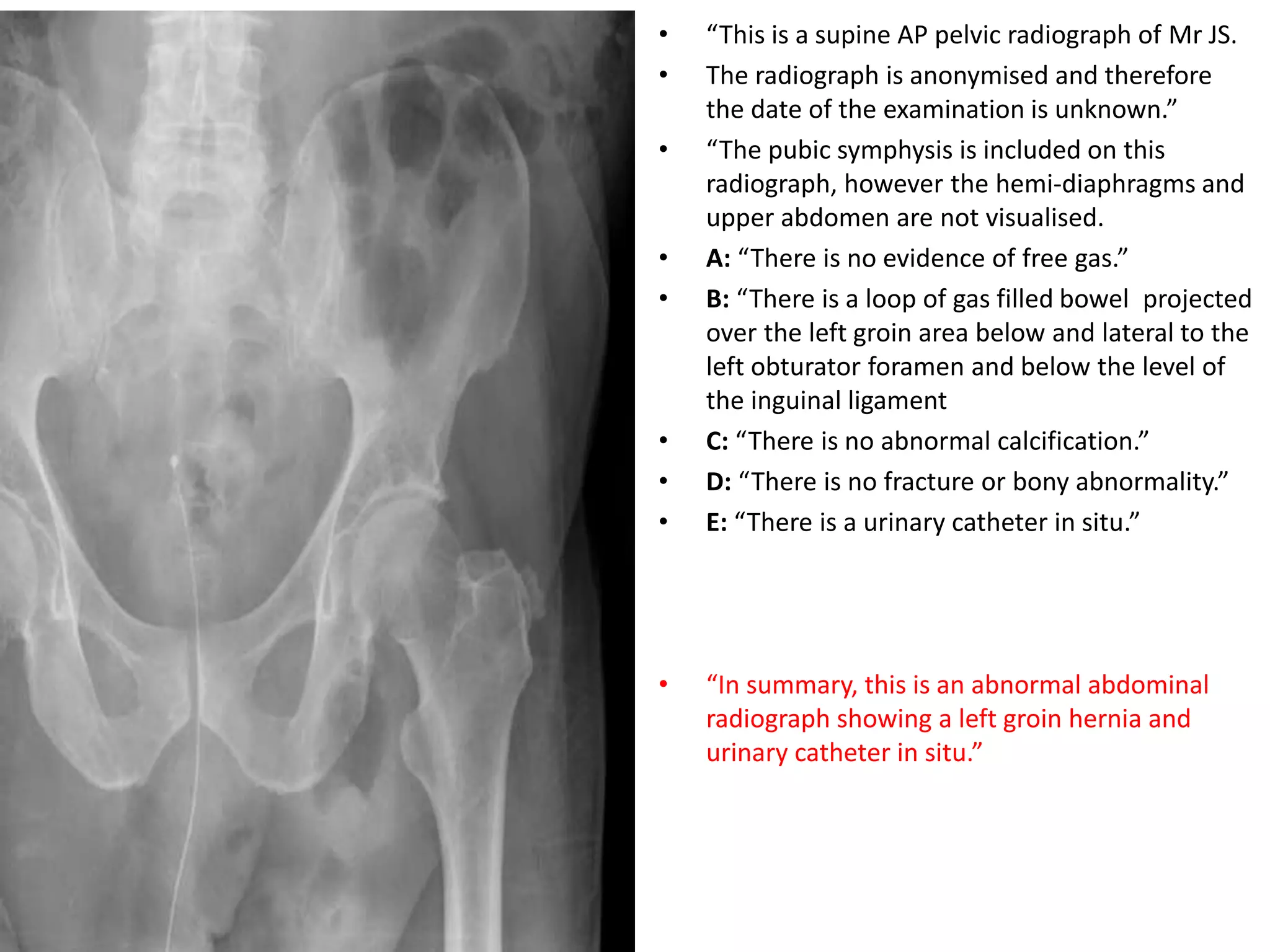 ABDOMINAL REPORT.pptx