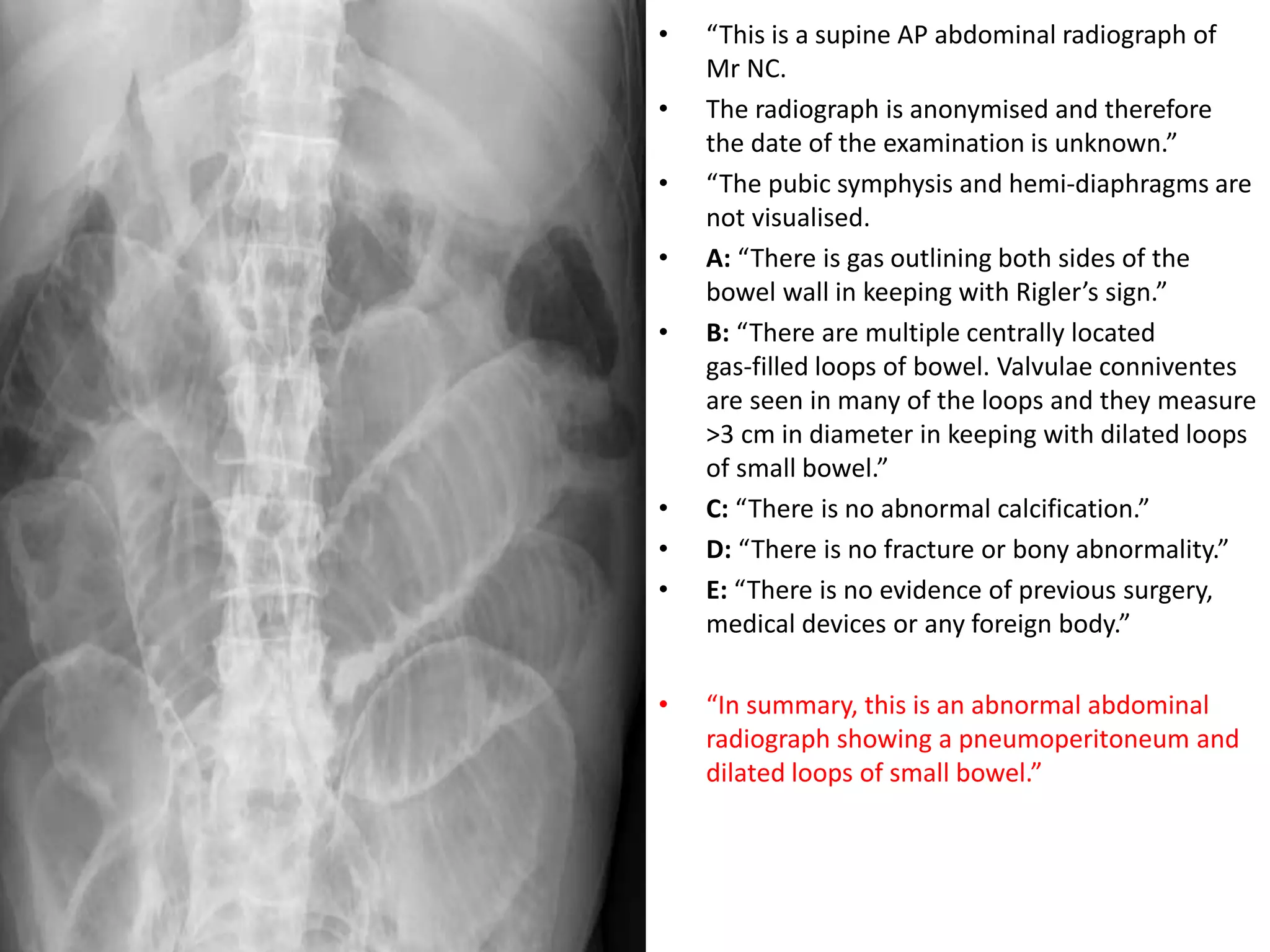 ABDOMINAL REPORT.pptx