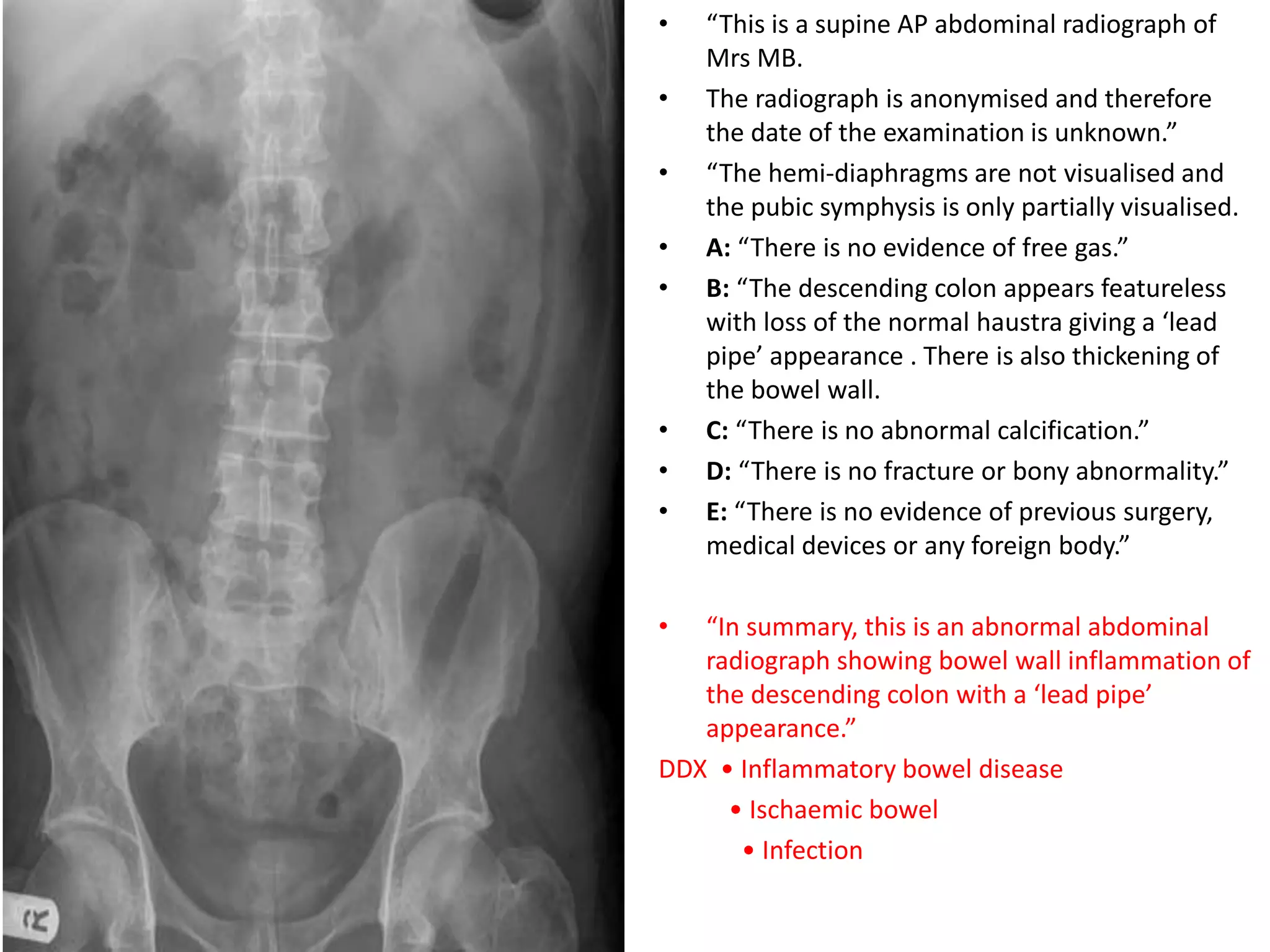 ABDOMINAL REPORT.pptx