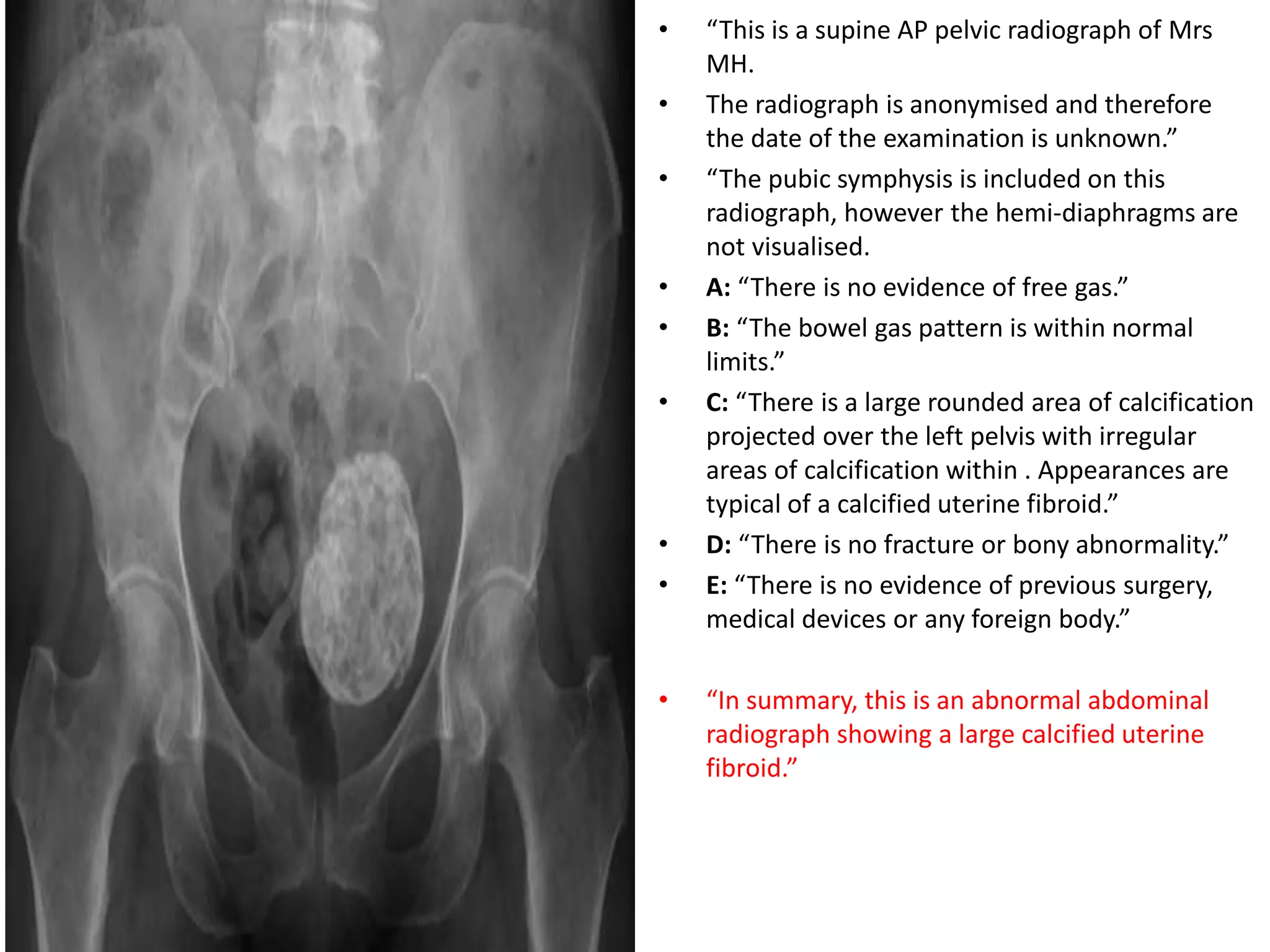 ABDOMINAL REPORT.pptx