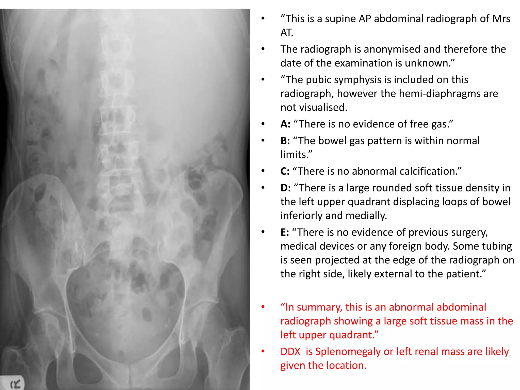 ABDOMINAL REPORT.pptx
