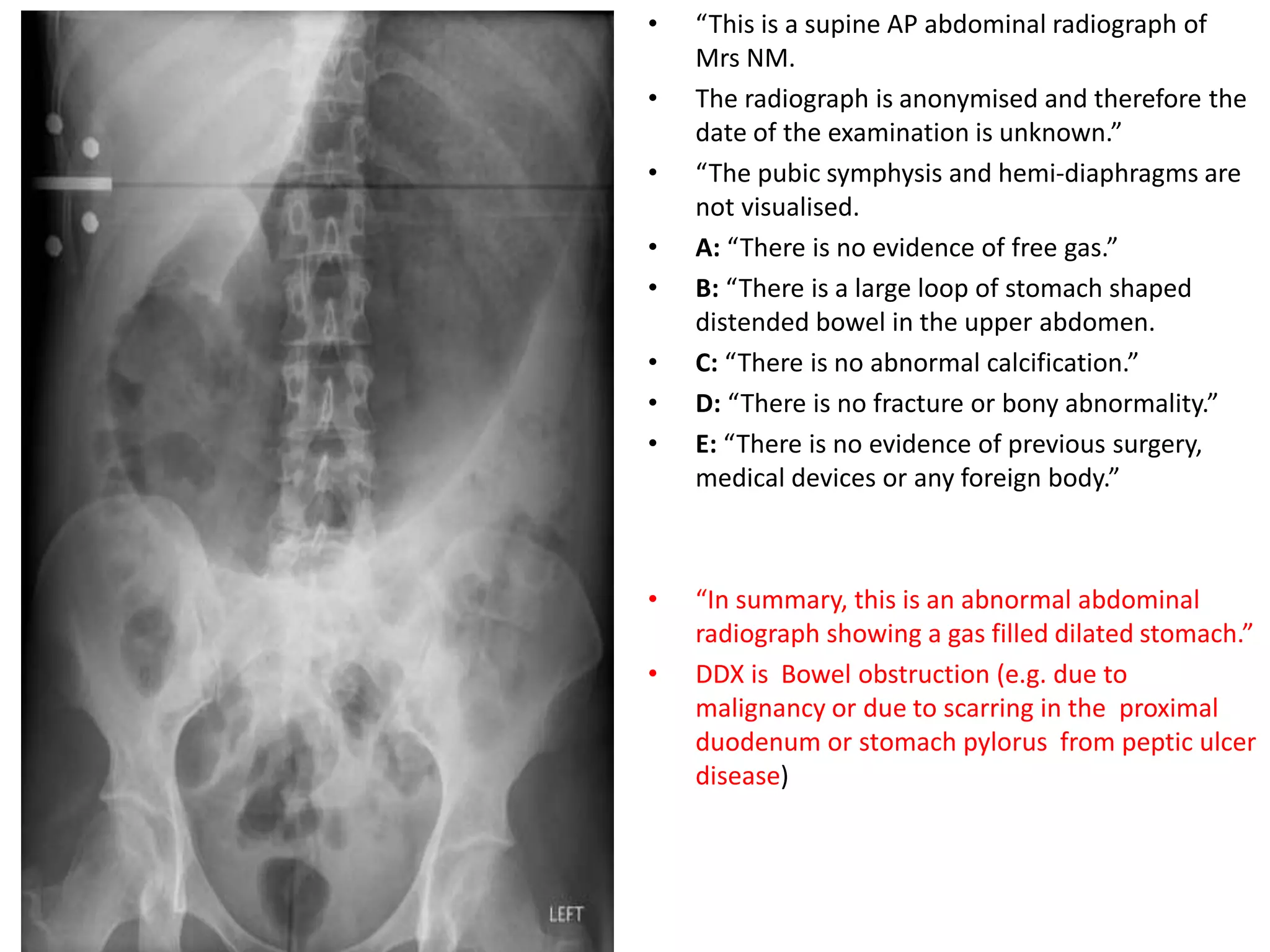 ABDOMINAL REPORT.pptx