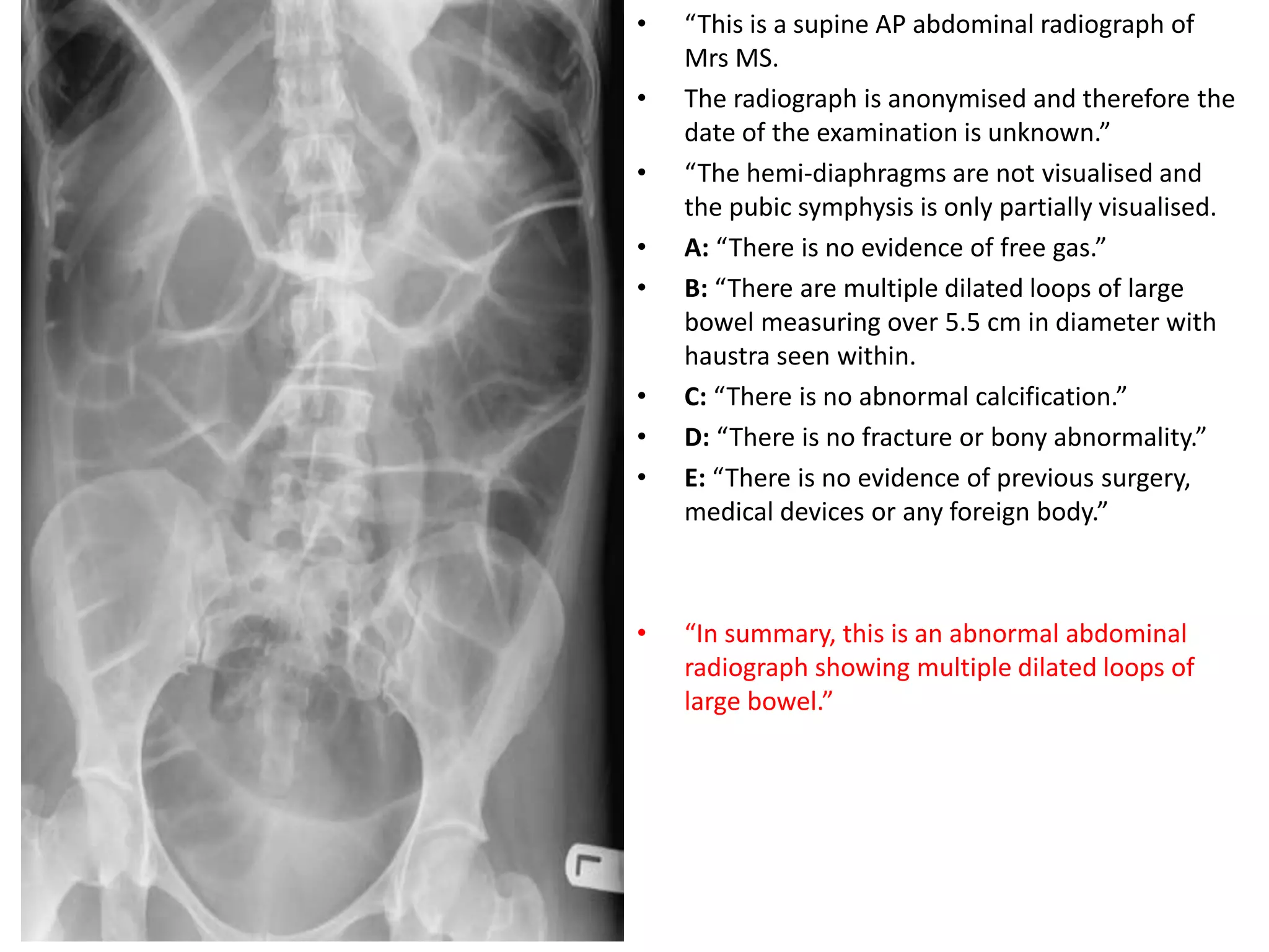 ABDOMINAL REPORT.pptx