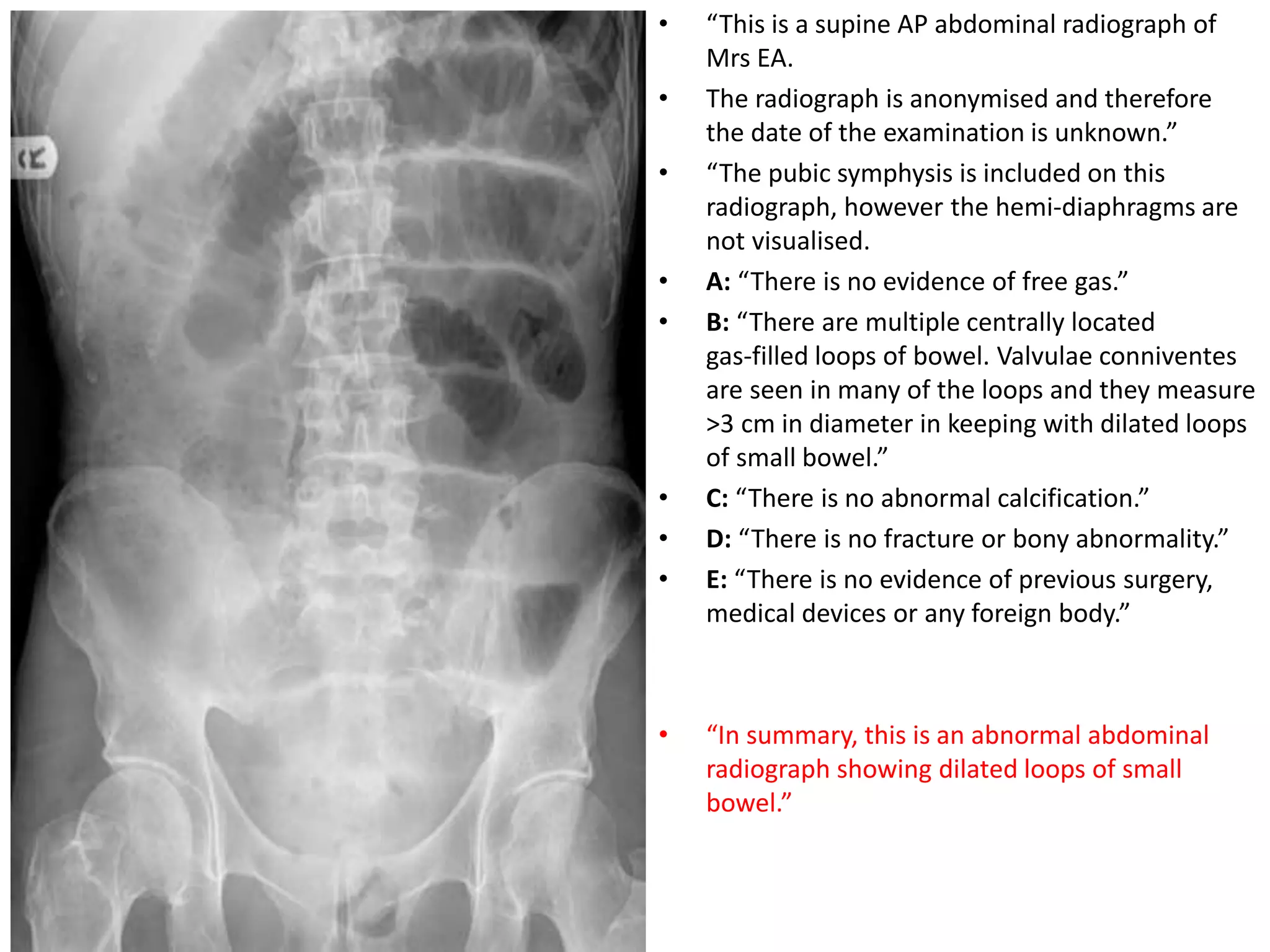 ABDOMINAL REPORT.pptx