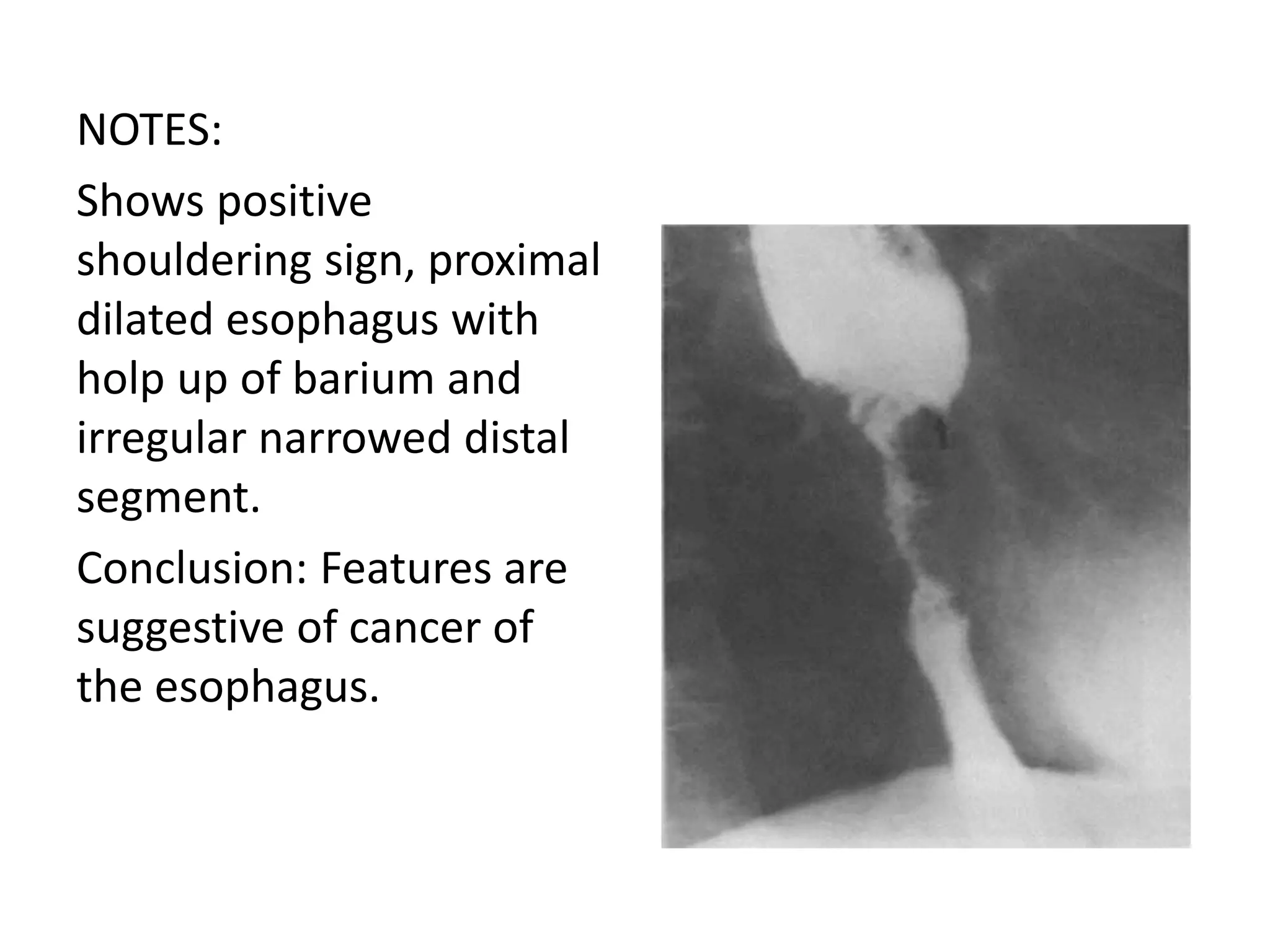 ABDOMINAL REPORT.pptx