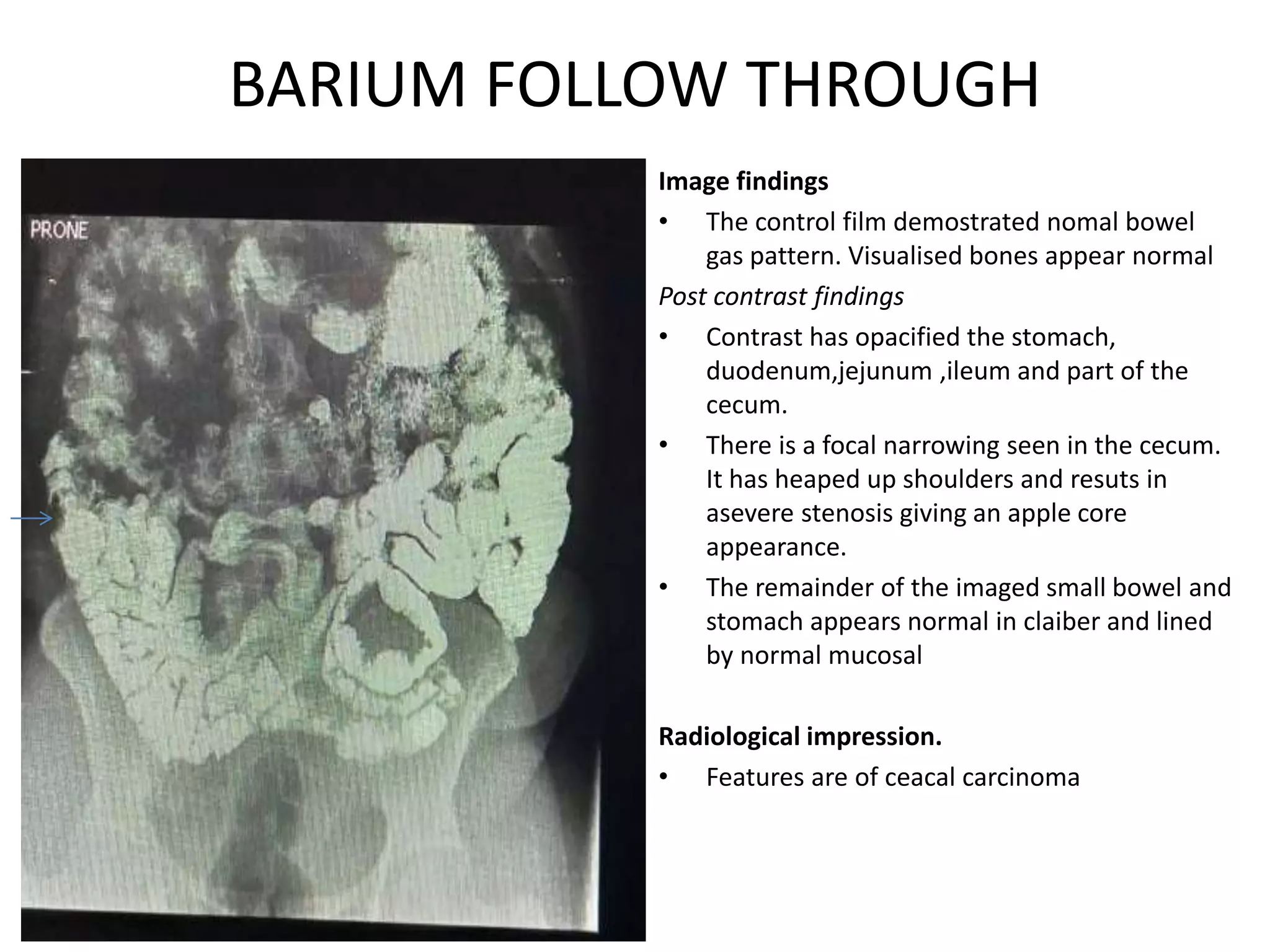 ABDOMINAL REPORT.pptx