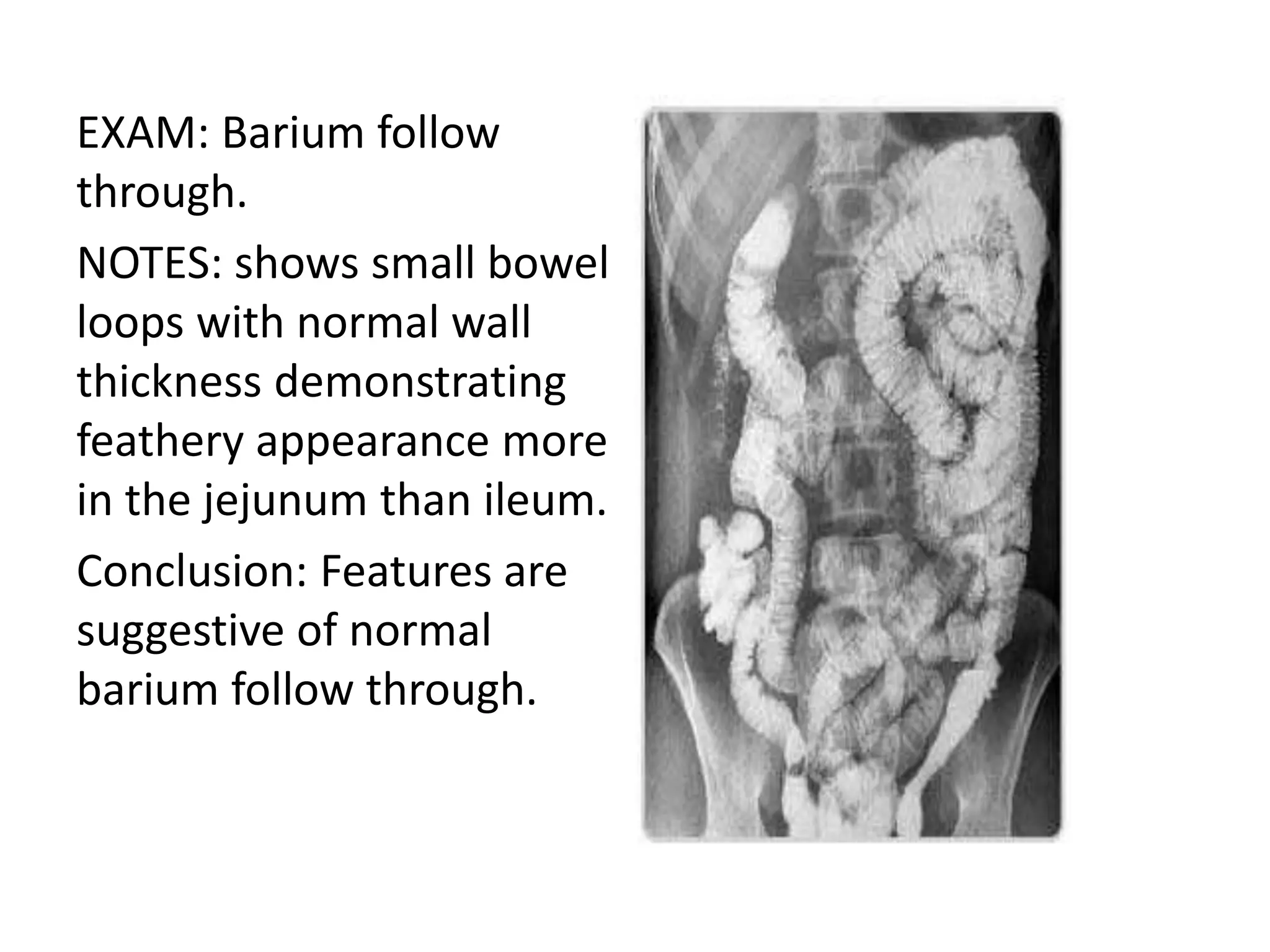 ABDOMINAL REPORT.pptx