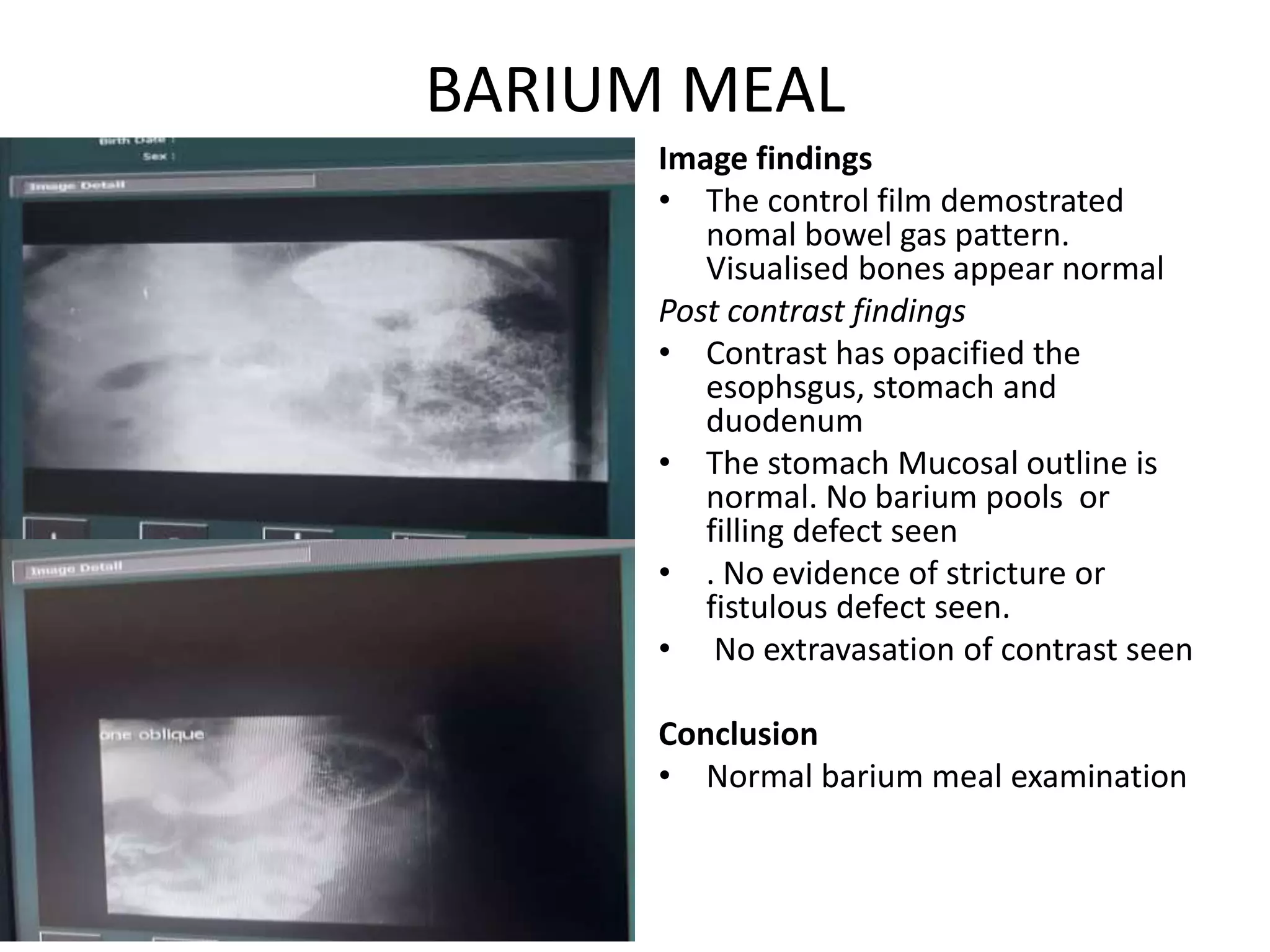 ABDOMINAL REPORT.pptx