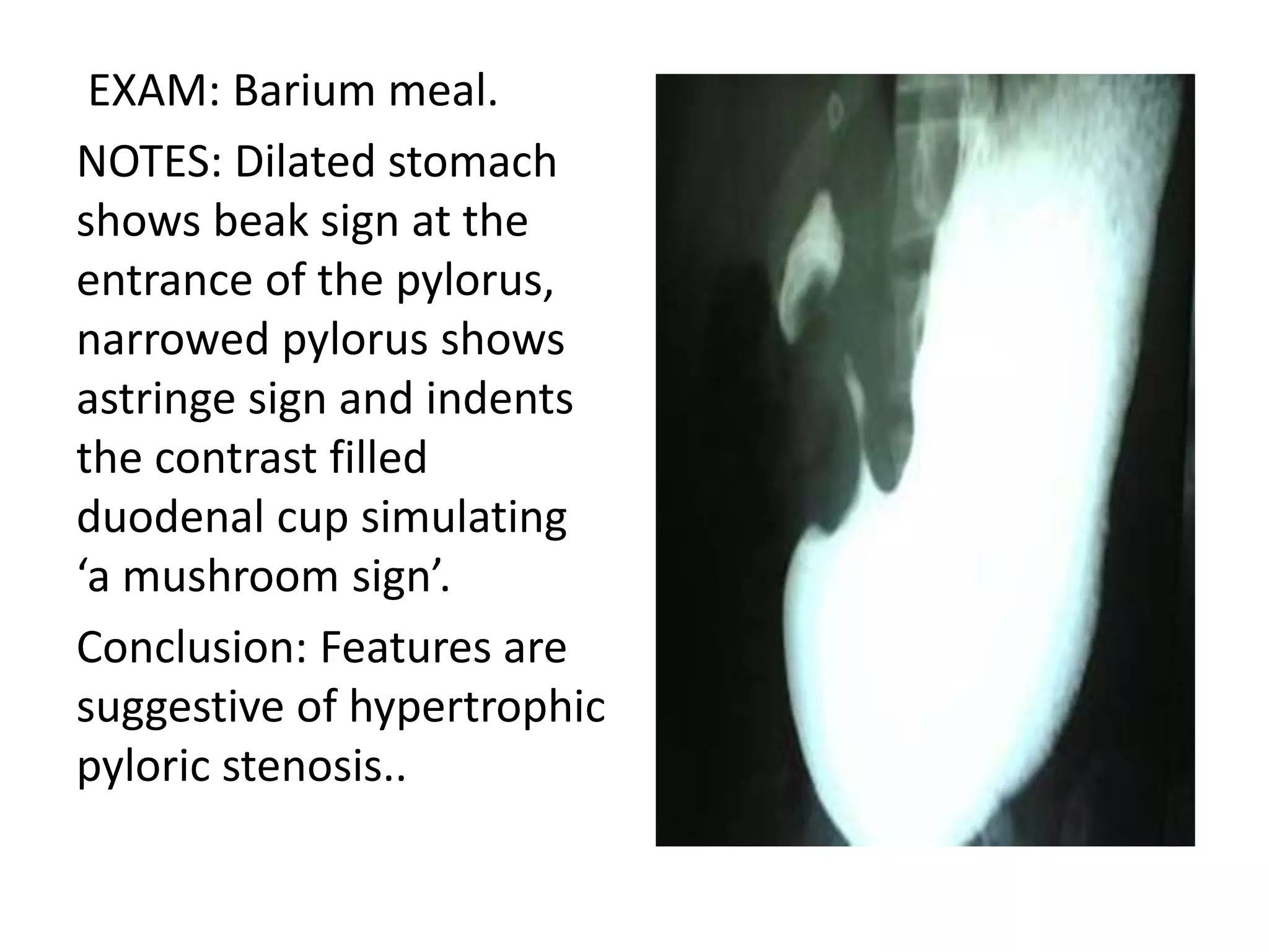 ABDOMINAL REPORT.pptx