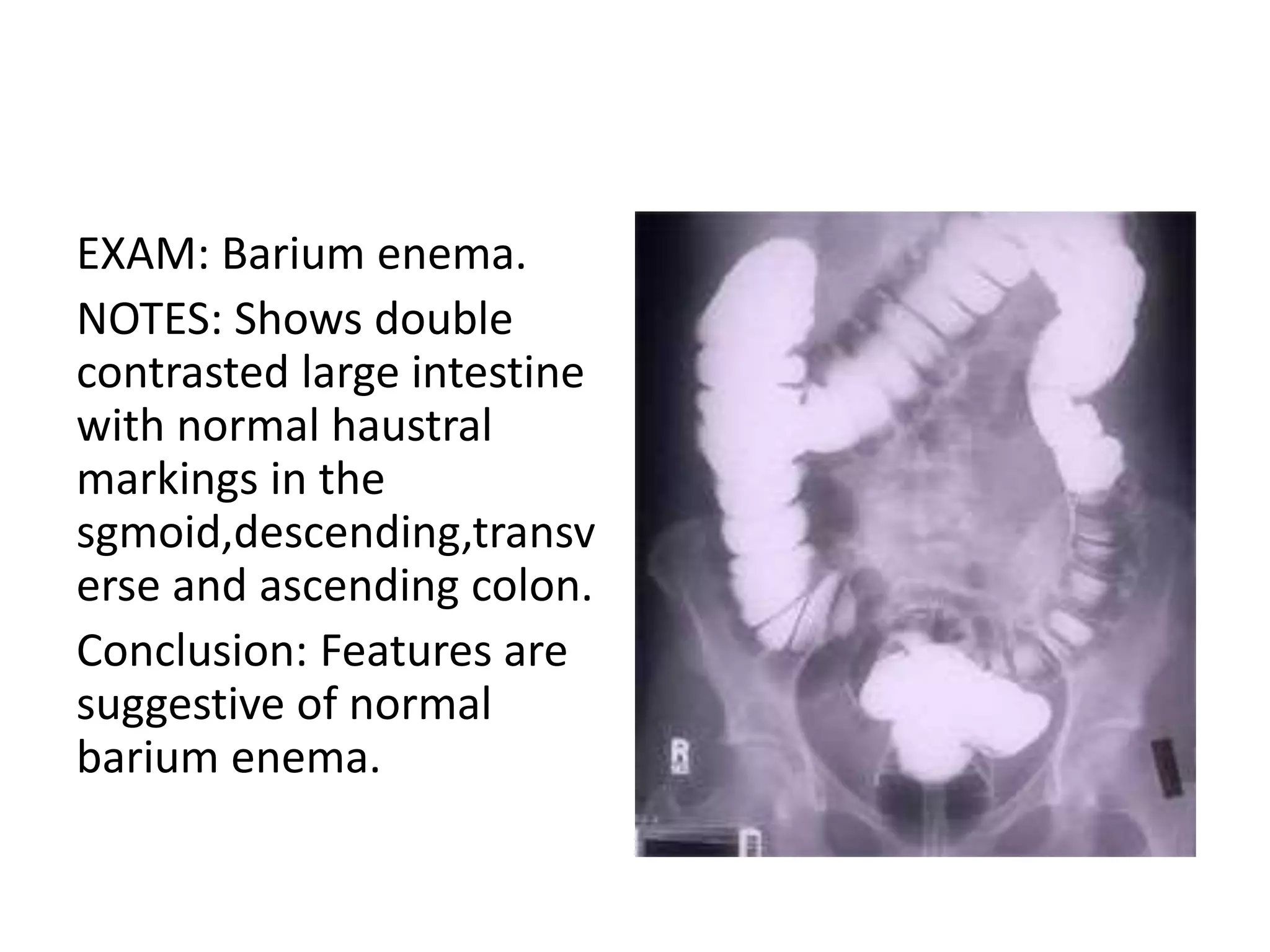 ABDOMINAL REPORT.pptx