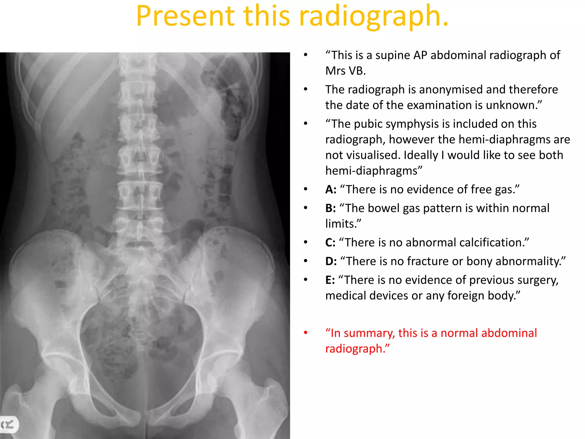 ABDOMINAL REPORT.pptx