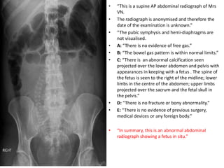 ABDOMINAL REPORT.pptx