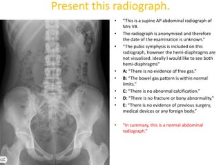 ABDOMINAL REPORT.pptx
