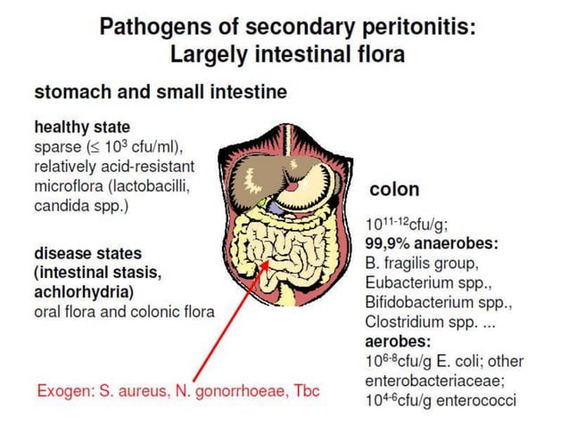 Abdominal Sepsis and Peritonitis | PPTX