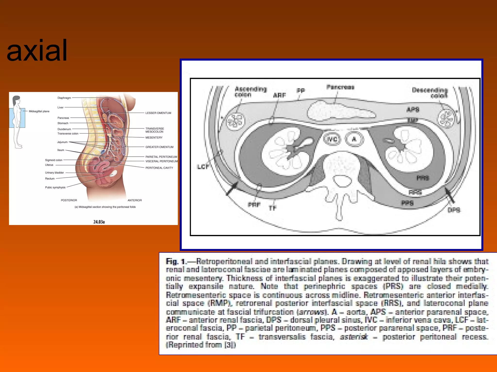 Radiological anatomy of abdominal spaces ...pathway of tumor and ...