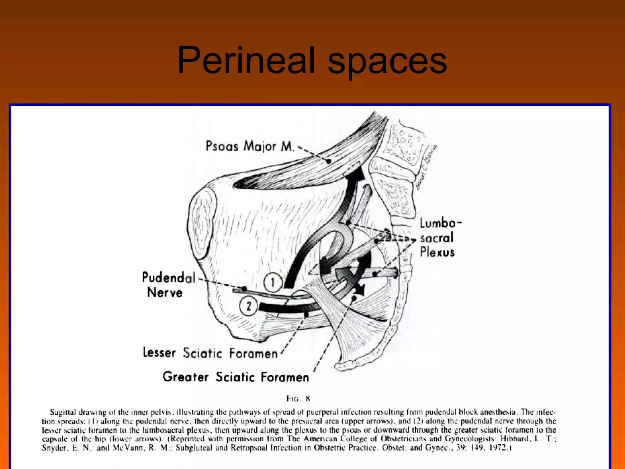 Radiological anatomy of abdominal spaces ...pathway of tumor and ...