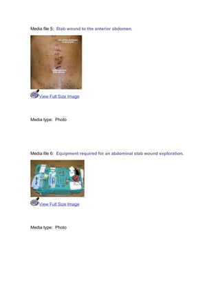 Abdominal stab wound exploration | DOC