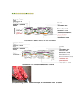Abdominal stab wound exploration | DOC