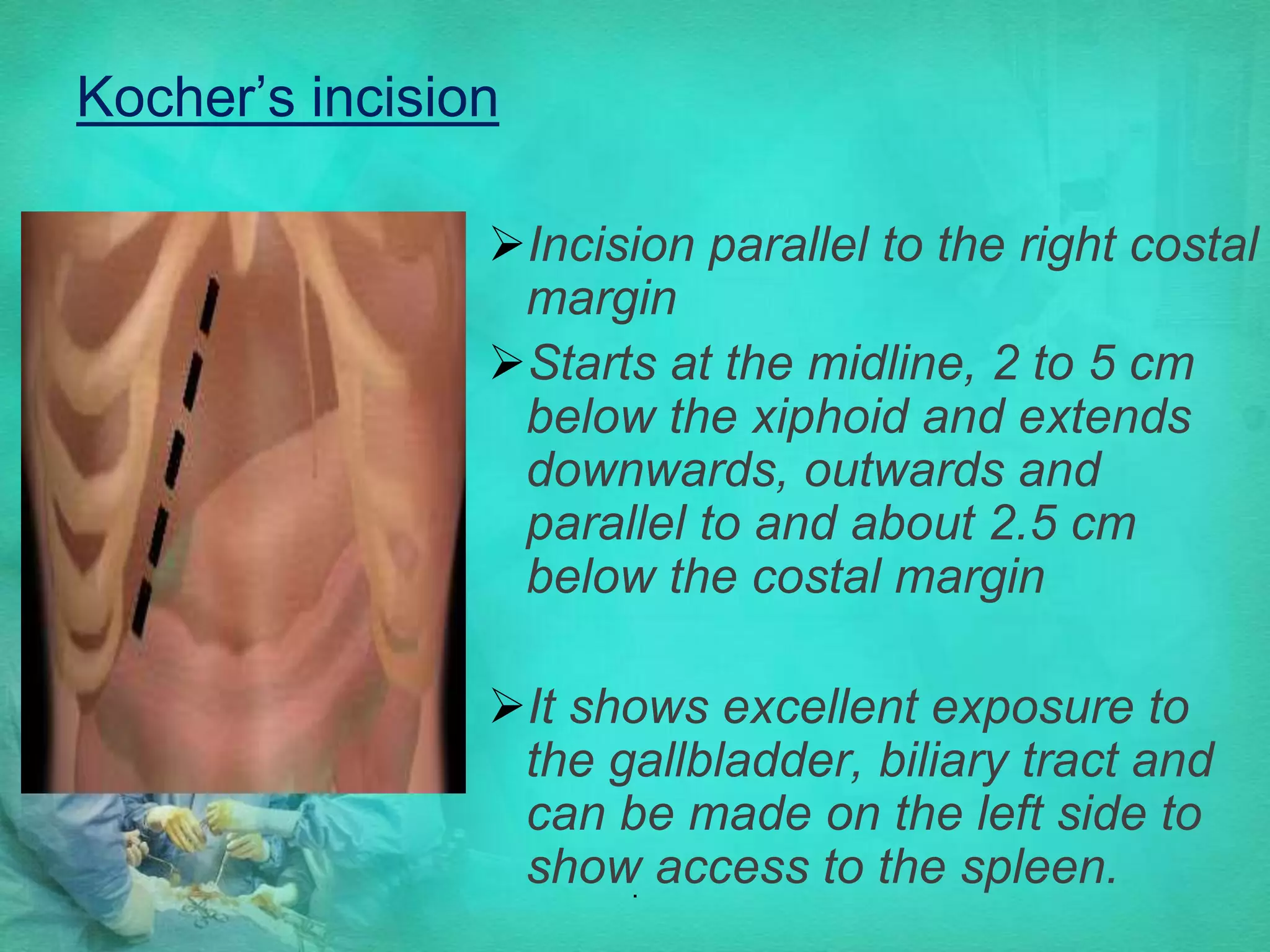 Abdominal surgery | PPTX