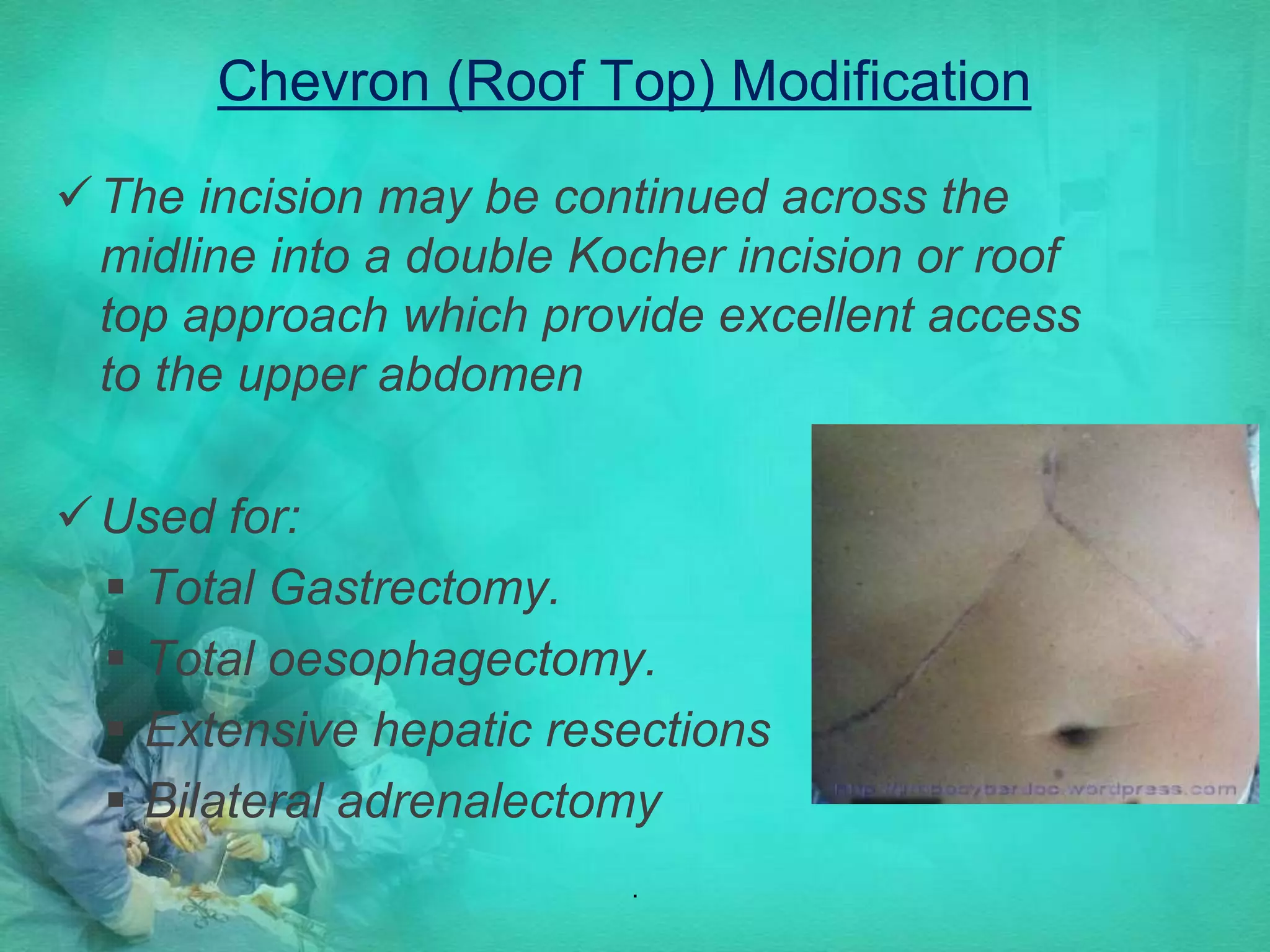 Abdominal surgery | PPTX