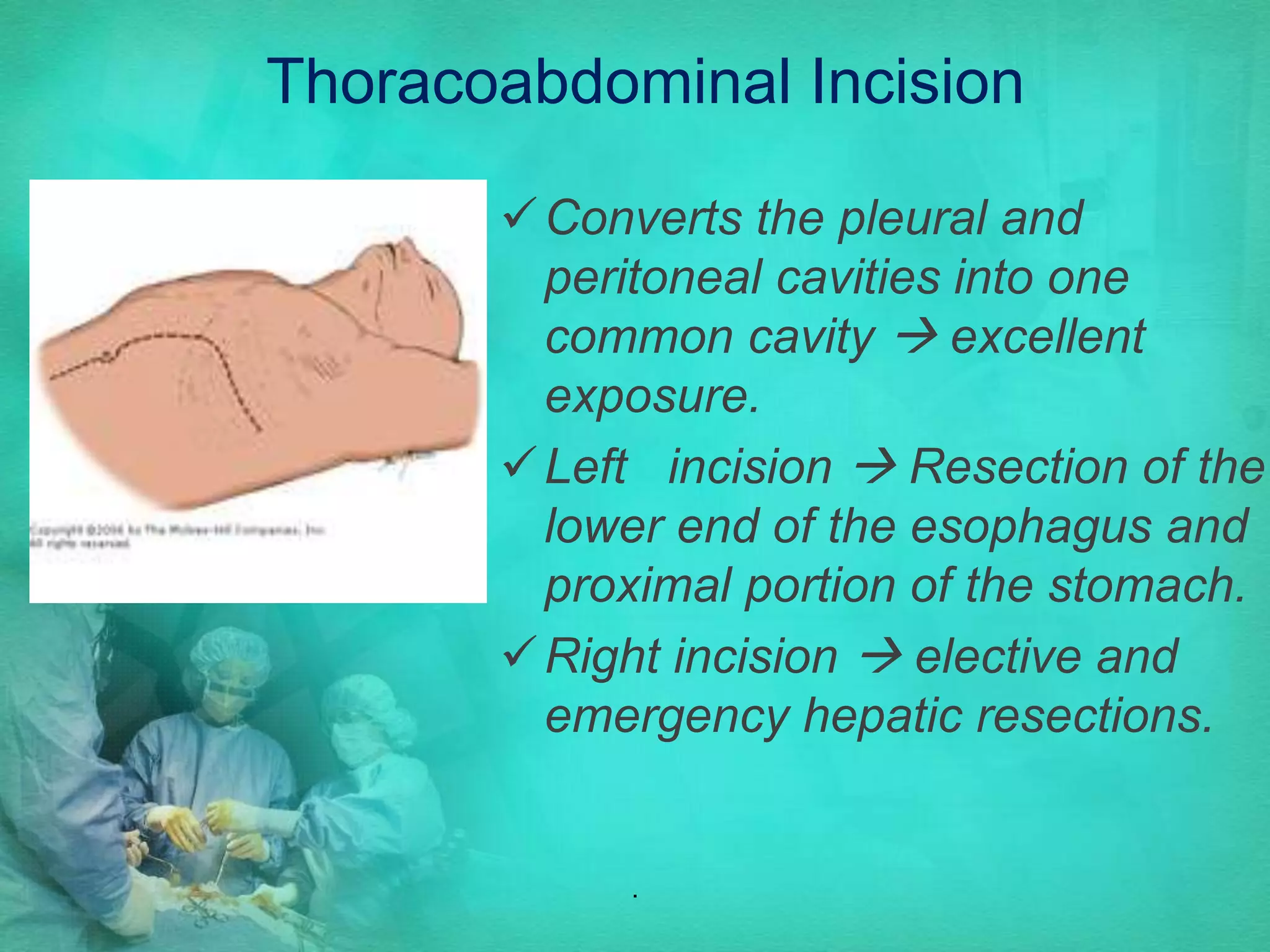 Abdominal surgery | PPTX