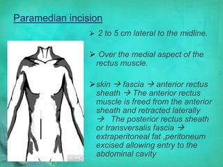 Abdominal surgery | PPTX