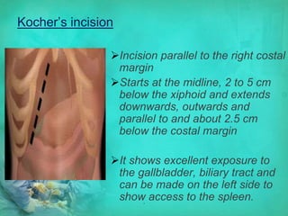Abdominal surgery | PPTX